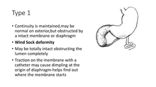 DUODENAL ATRESIA.pptx