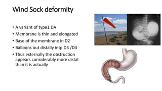 DUODENAL ATRESIA.pptx