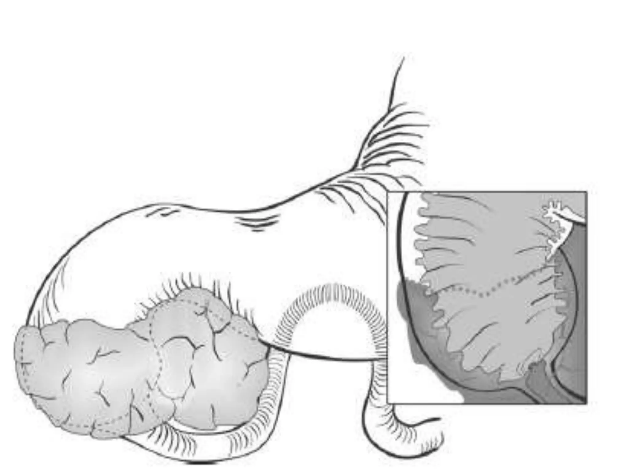 Duodenal Atresia Stenosis Pranaya Ppt Ppt
