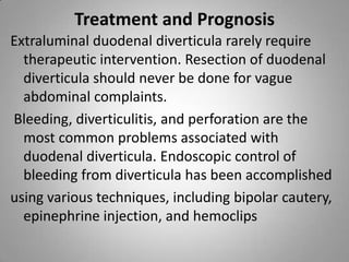 Duodenal diverticula | PPTX