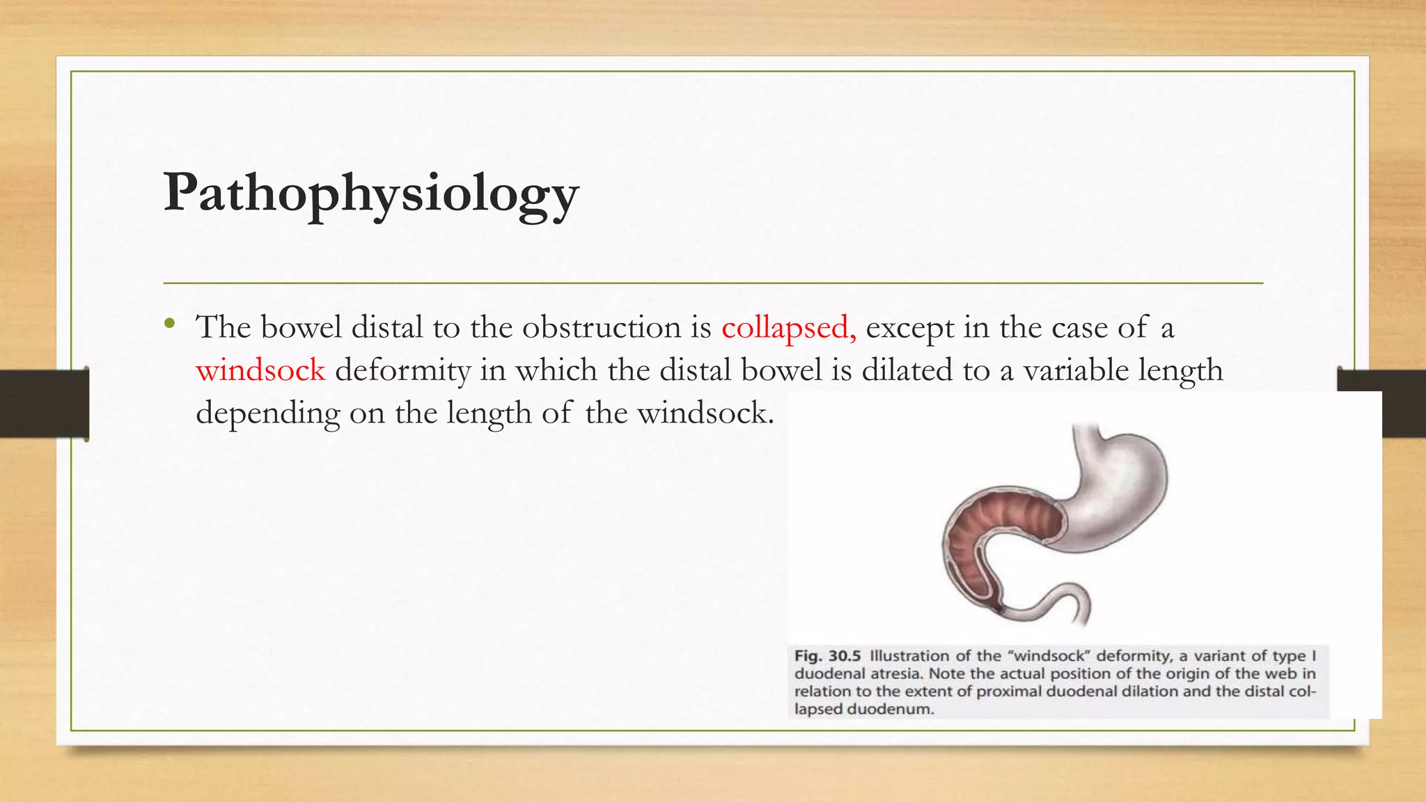 Duodenal obstruction | PPTX