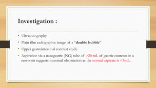 Duodenal obstruction | PPTX