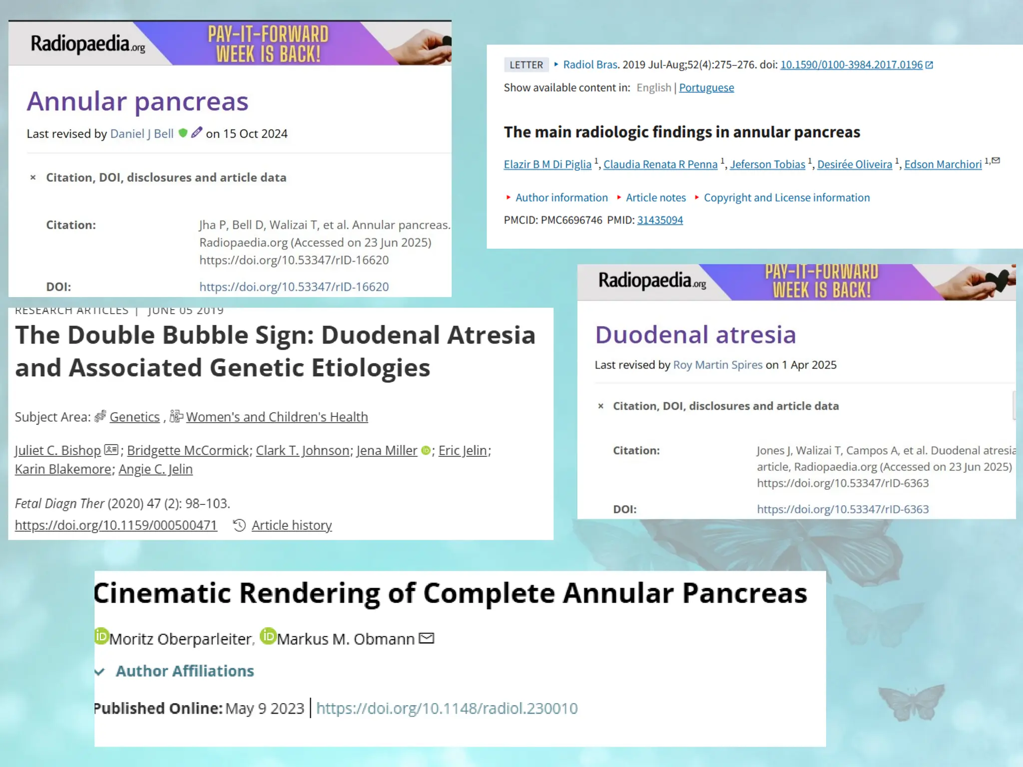 Duodenal obstruction, annular pancrease and duodenal atresia | PPTX