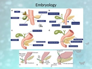 Duodenal obstruction, annular pancrease and duodenal atresia | PPTX