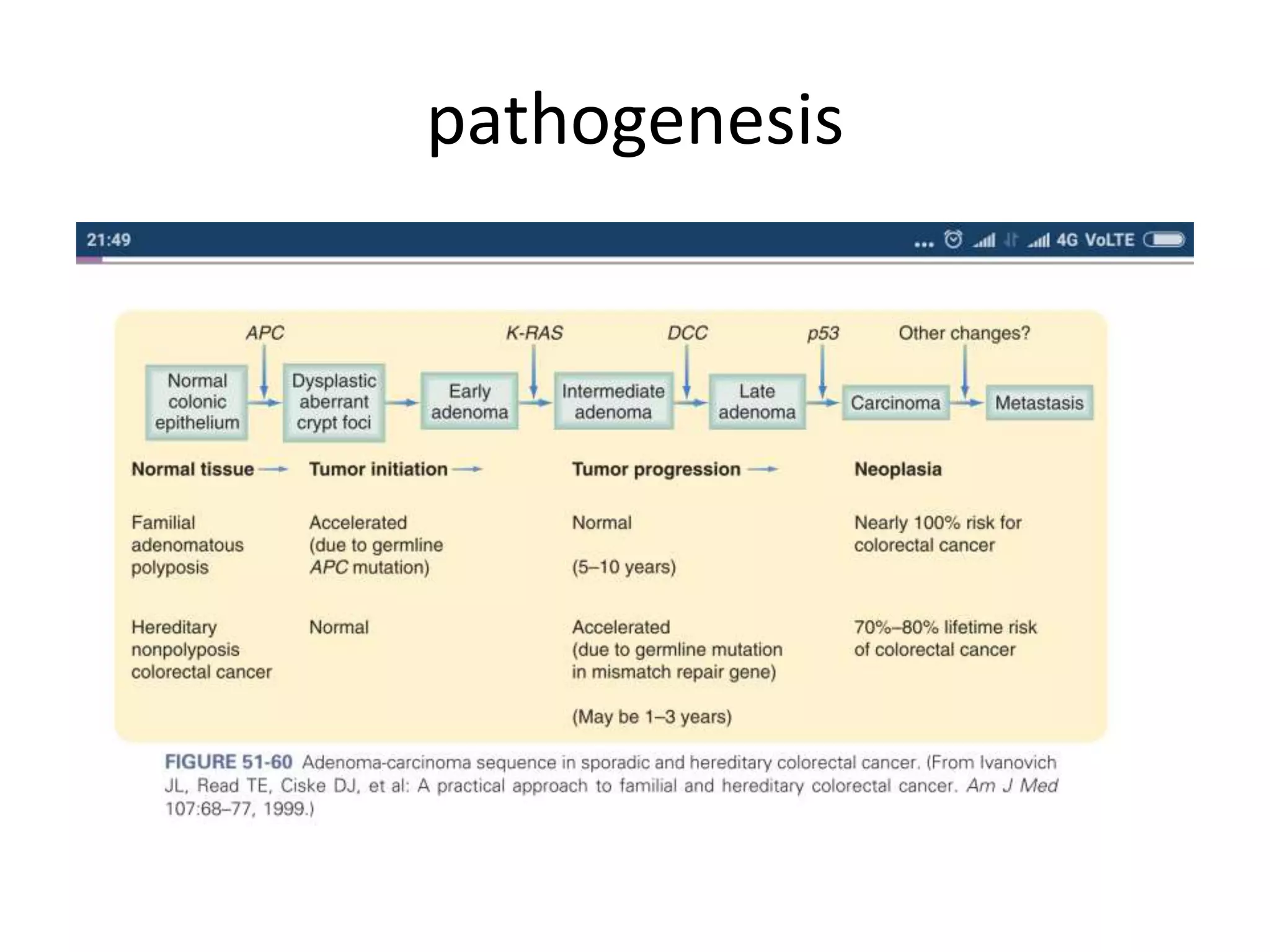 Duodenal Polyp Ppt