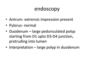 Duodenal polyp | PPTX