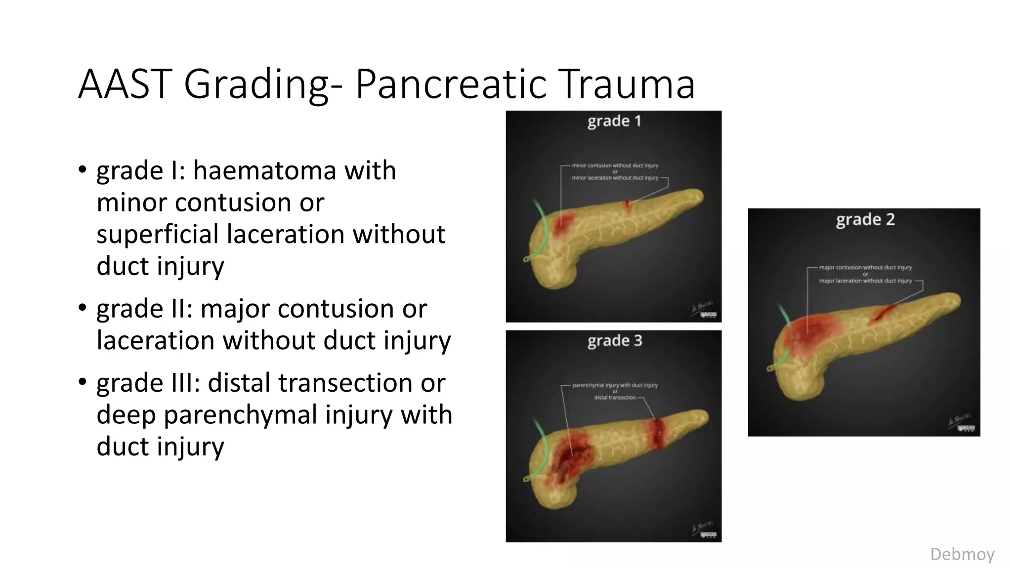 Duodeno Pancreatic Injuries - Evaluation and Assessment.pptx