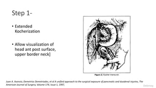 Duodeno Pancreatic Injuries - Evaluation and Assessment.pptx