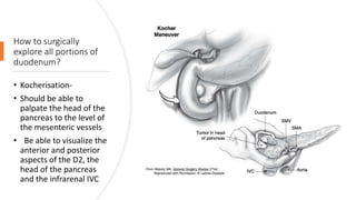 Duodeno Pancreatic Injuries - Evaluation and Assessment.pptx