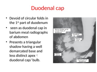 Duodenum.pptx........................... | PPTX