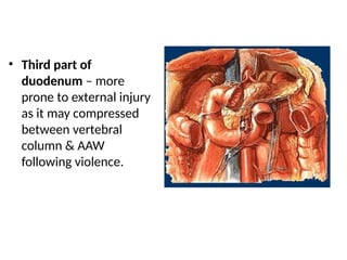 Duodenum.pptx........................... | PPTX