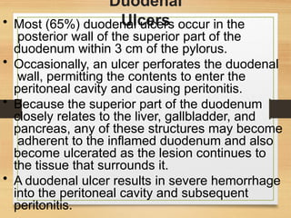 DUODENUM ANATOMY & Clinical Anatomy.pptx