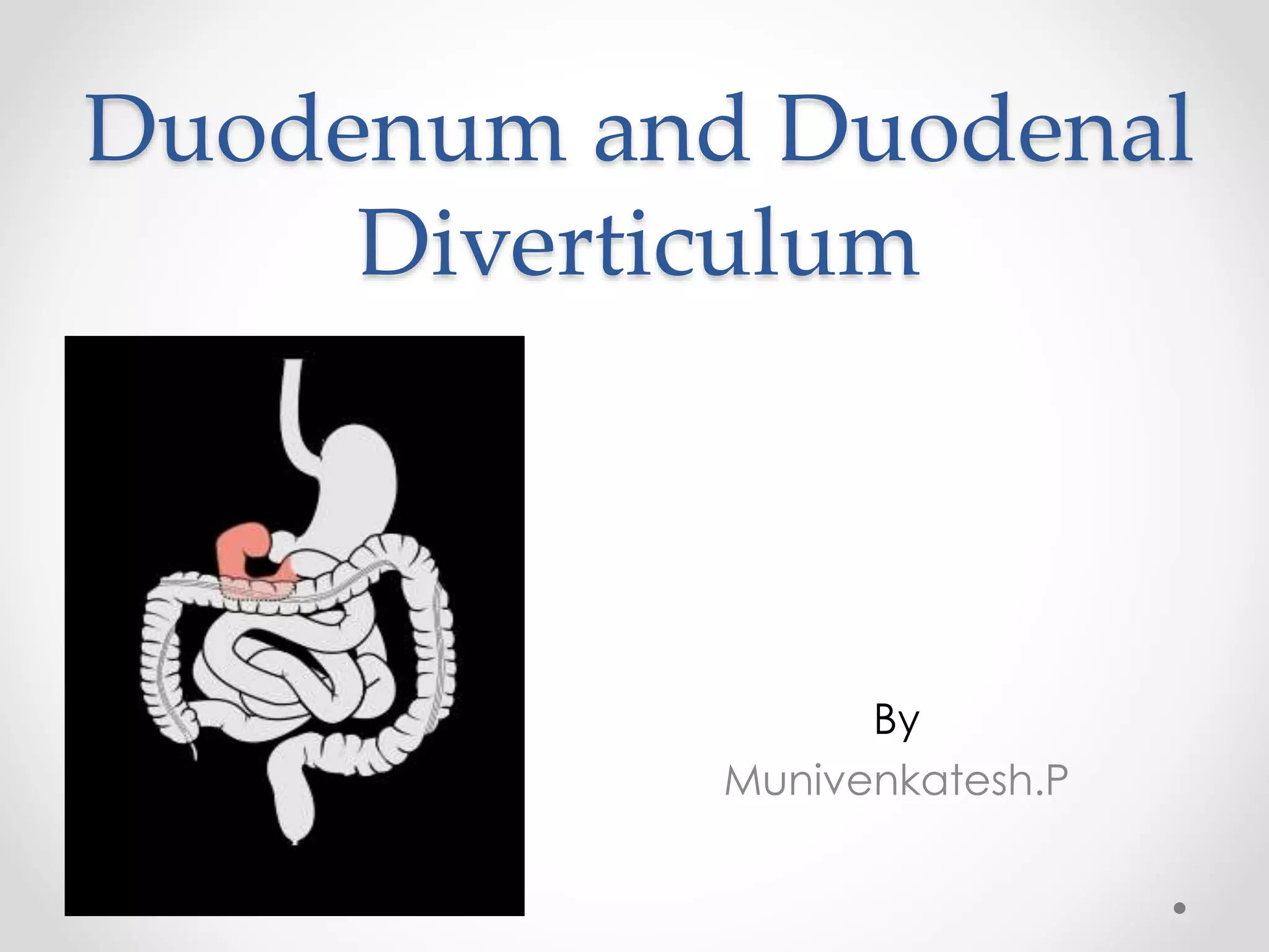 Duodenum and Duodenal Diverticulum: Causes, Symptoms, Diagnosis and ...