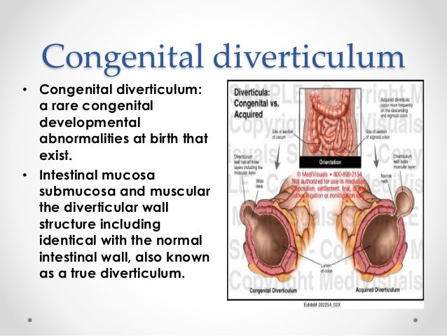 Duodenum and duodenal diverticulum