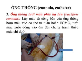 thiết lập các đường vào mạch máu ứng dụng ecmo | PDF