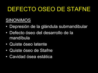 Defecto Oseo de Stafne | PPT