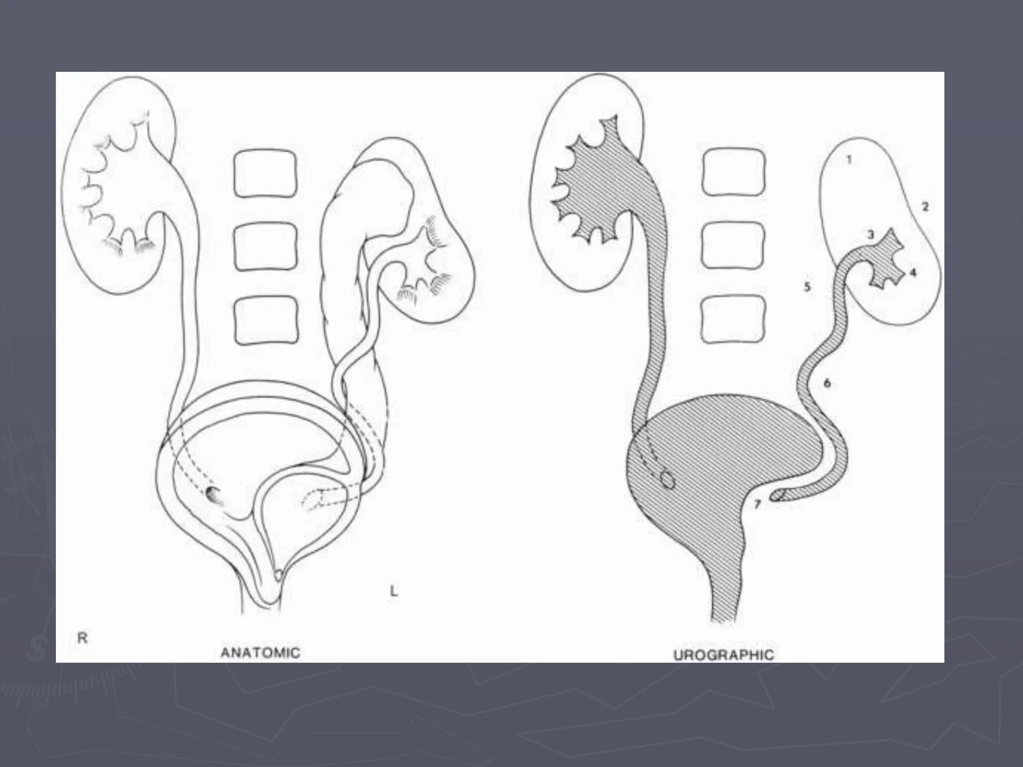 DUPLEX COLLECTING SYSTEM FOR DOCTORS .pptx