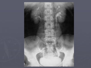 DUPLEX COLLECTING SYSTEM FOR DOCTORS .pptx