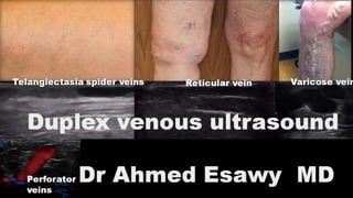 Duplex peripheral veins | PPT