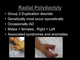 Duplicated thumb | PPT