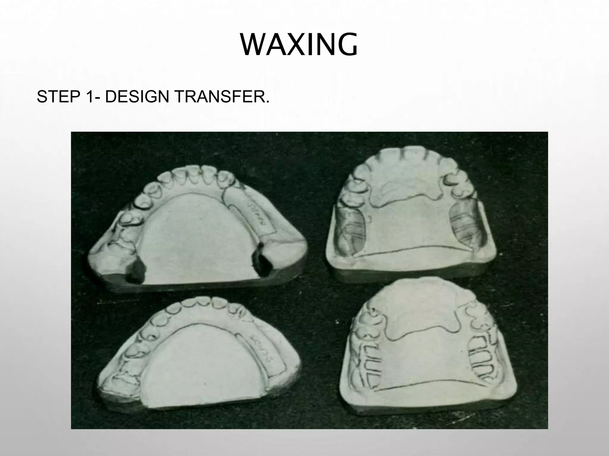 Duplication and wax up in rpd | PPT