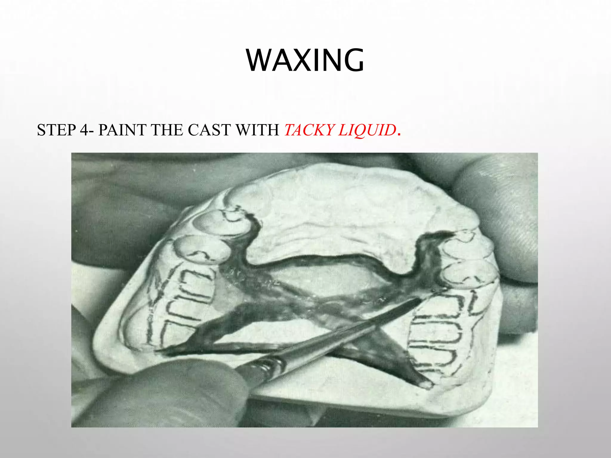 Duplication and wax up in rpd | PPT