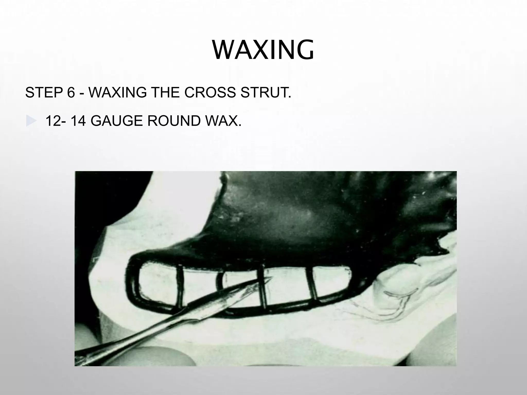 Duplication and wax up in rpd | PPT