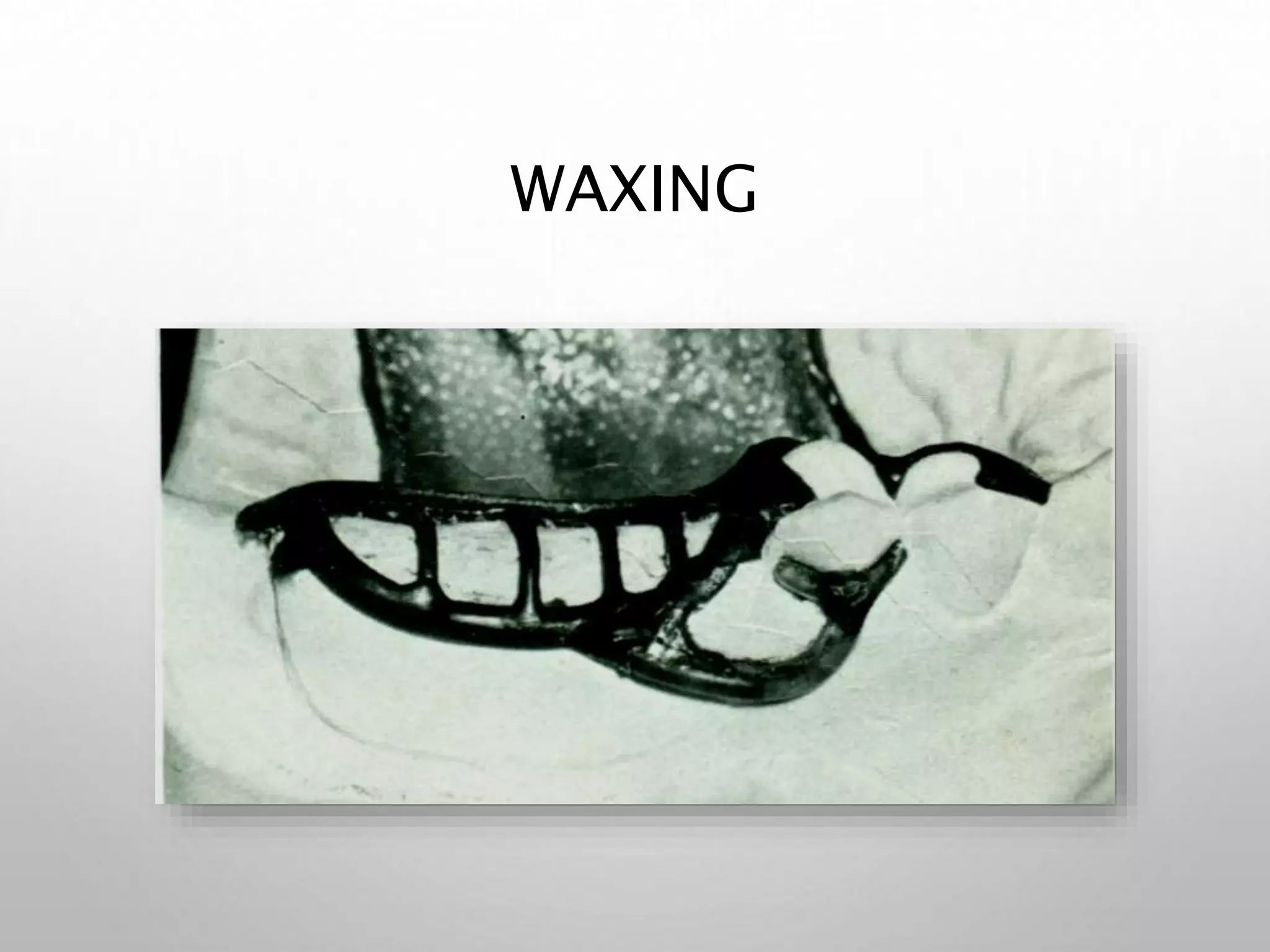 Duplication and wax up in rpd | PPT