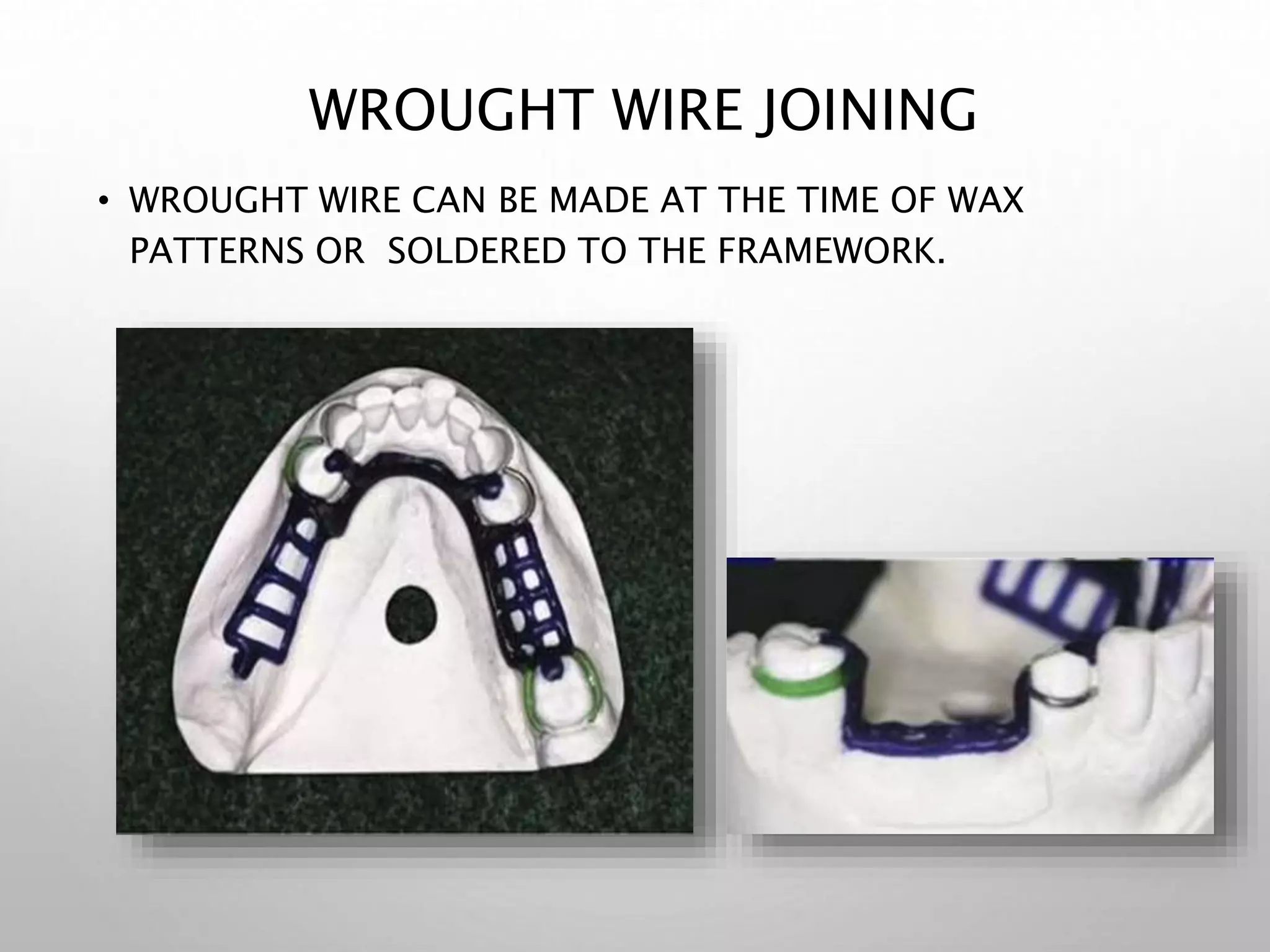 Duplication and wax up in rpd | PPT