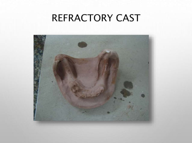Duplication and wax up in rpd | PPT | Chemistry | Science