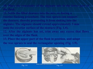 Duplication of complete denture prosthesis / endodontic courses | PPT