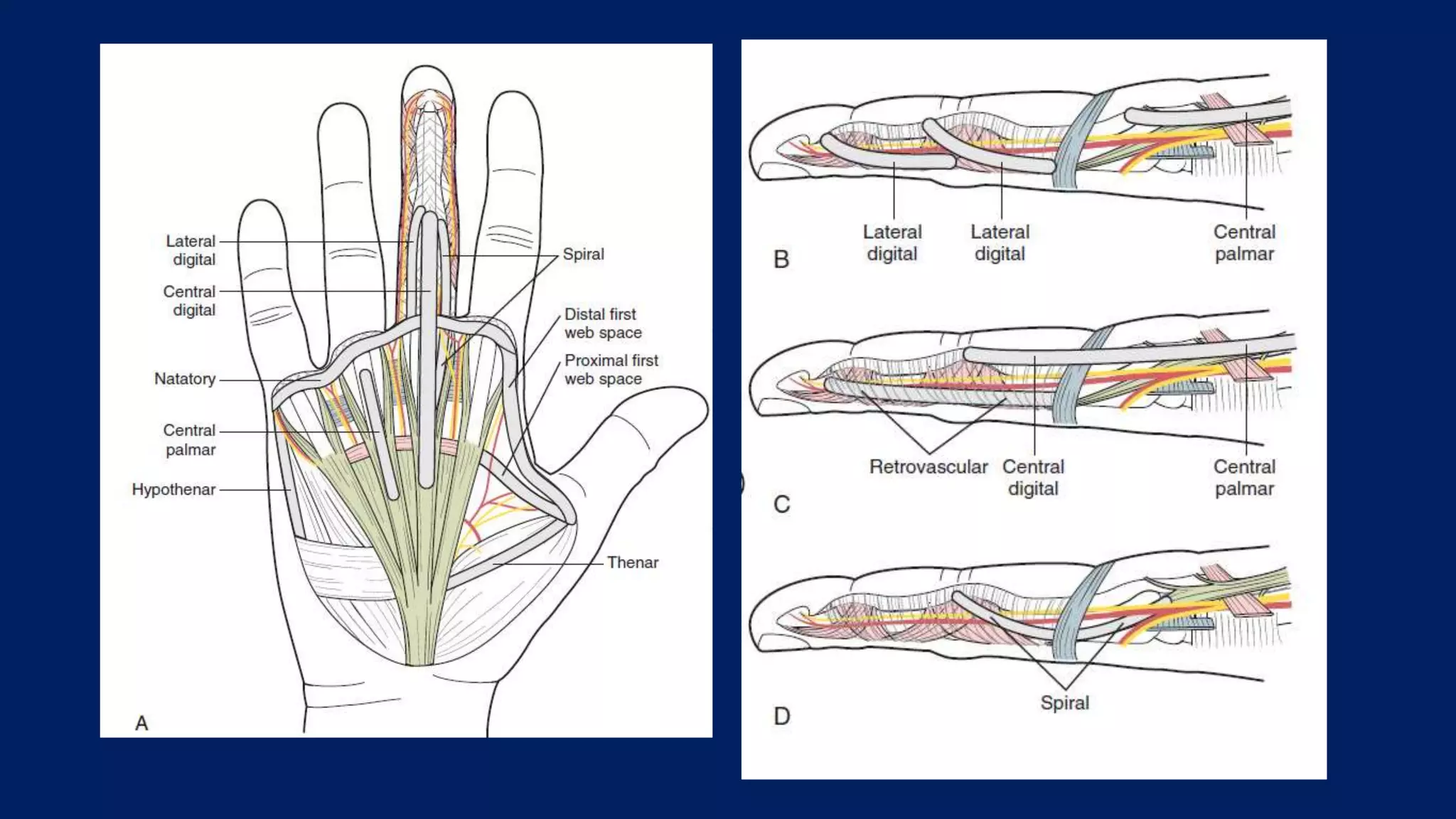 Dupuytren's contracture | PPTX