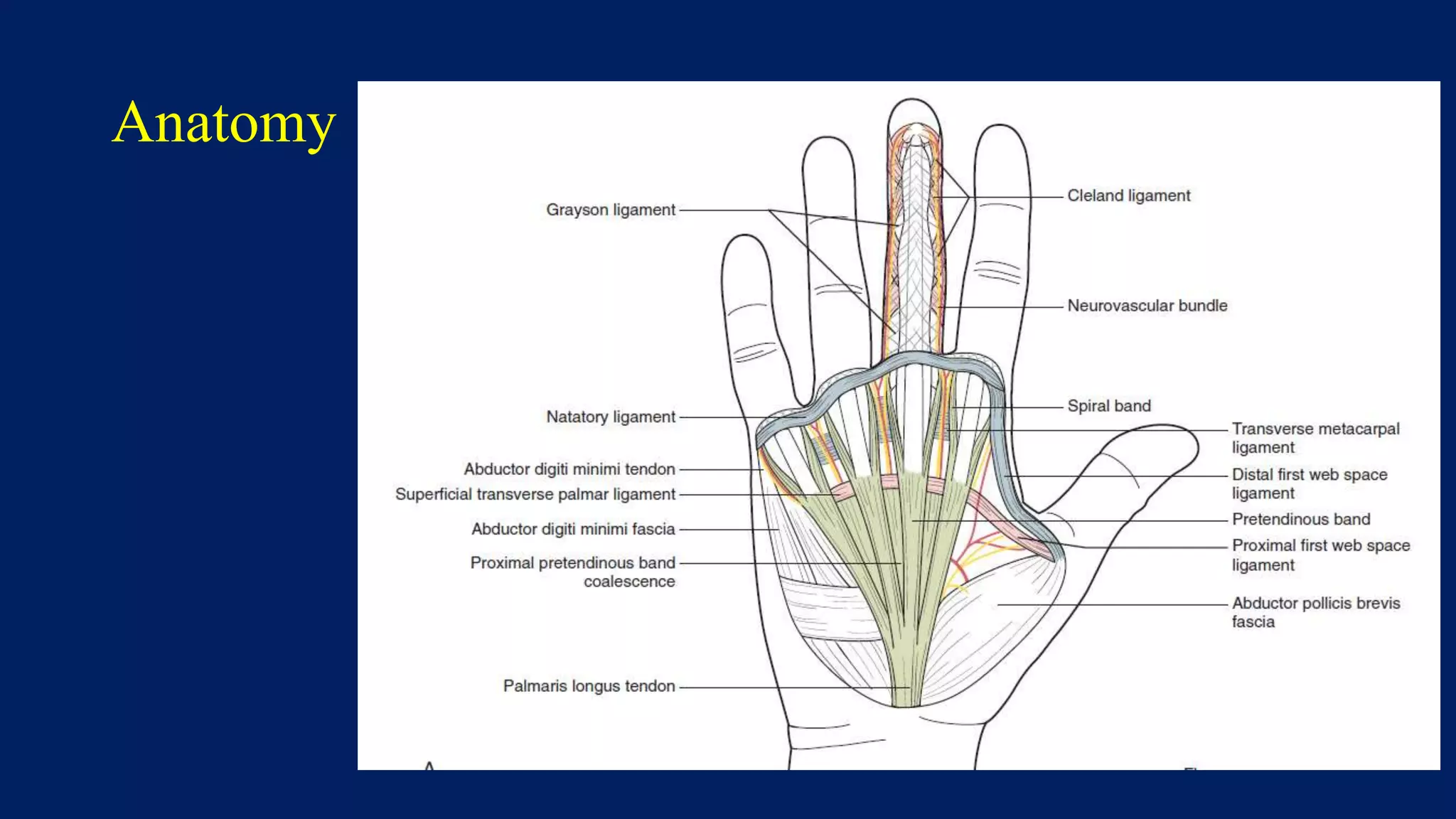 Dupuytren's contracture | PPTX