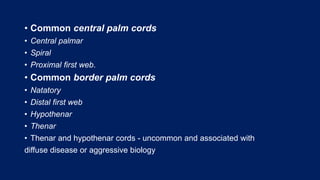 Dupuytren's contracture | PPTX