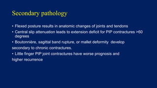 Dupuytren's contracture | PPTX
