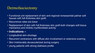Dupuytren's contracture | PPTX