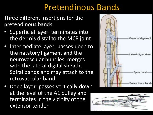 Dupuytrens Contracture