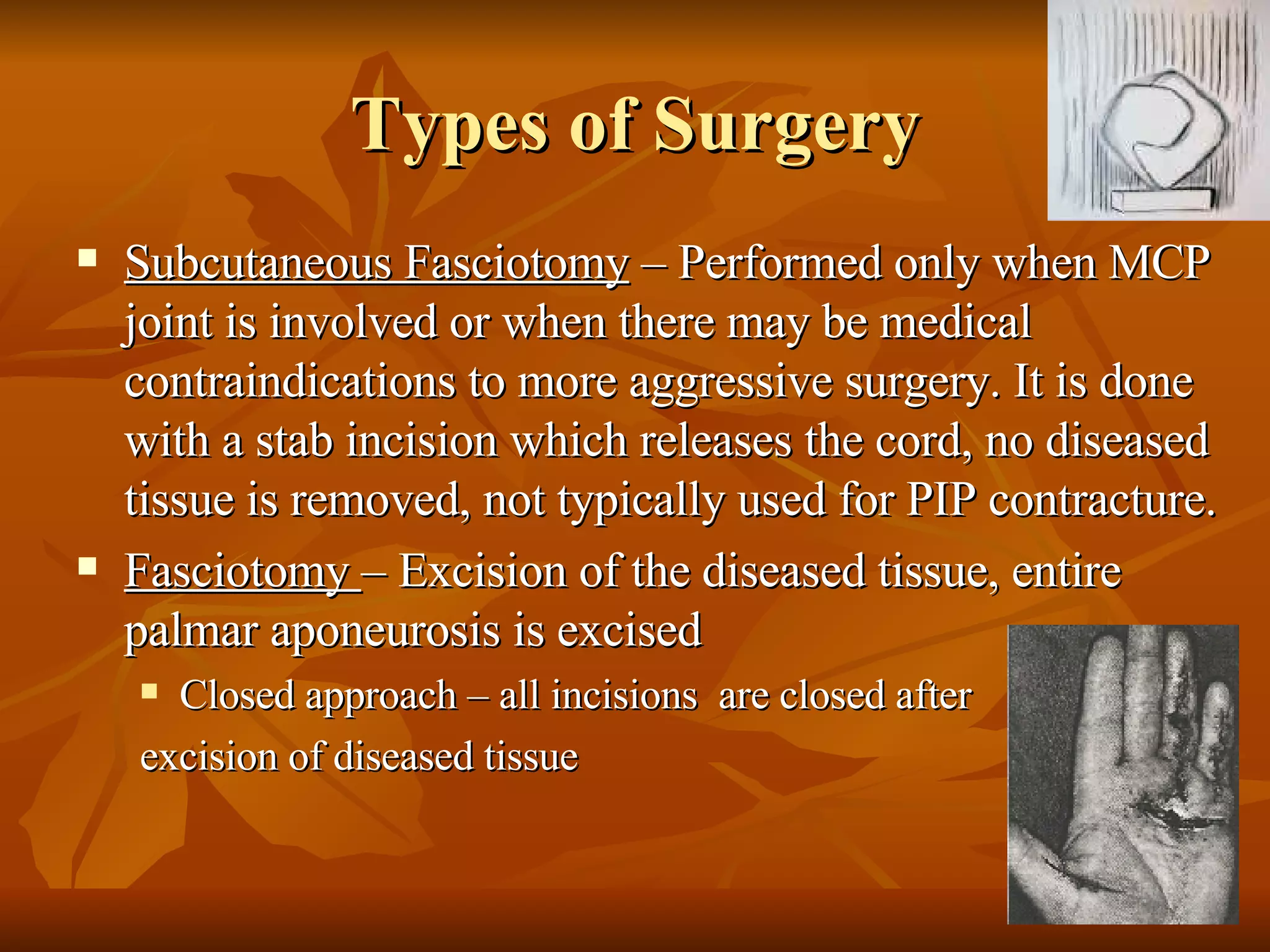 Dupuytrens Contracture | PPT