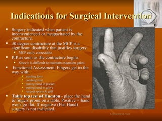 Dupuytrens Contracture | PPT