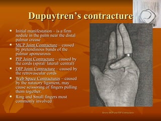 Dupuytrens Contracture | PPT