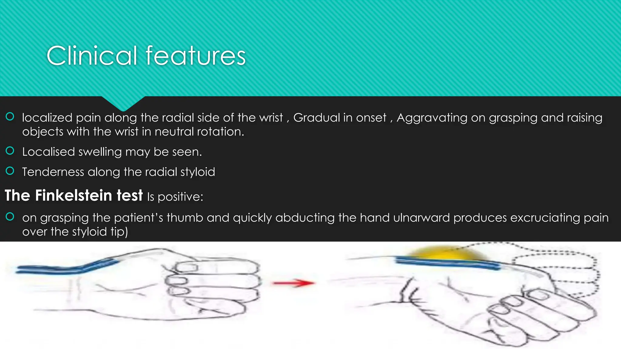 DUPUYTREN'S contracture and dequrevains tenosynovitis | PPTX