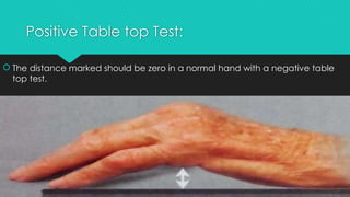 DUPUYTREN'S contracture and dequrevains tenosynovitis | PPTX