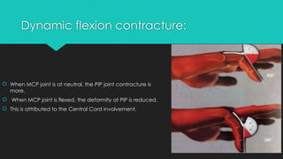 DUPUYTREN'S contracture and dequrevains tenosynovitis | PPTX