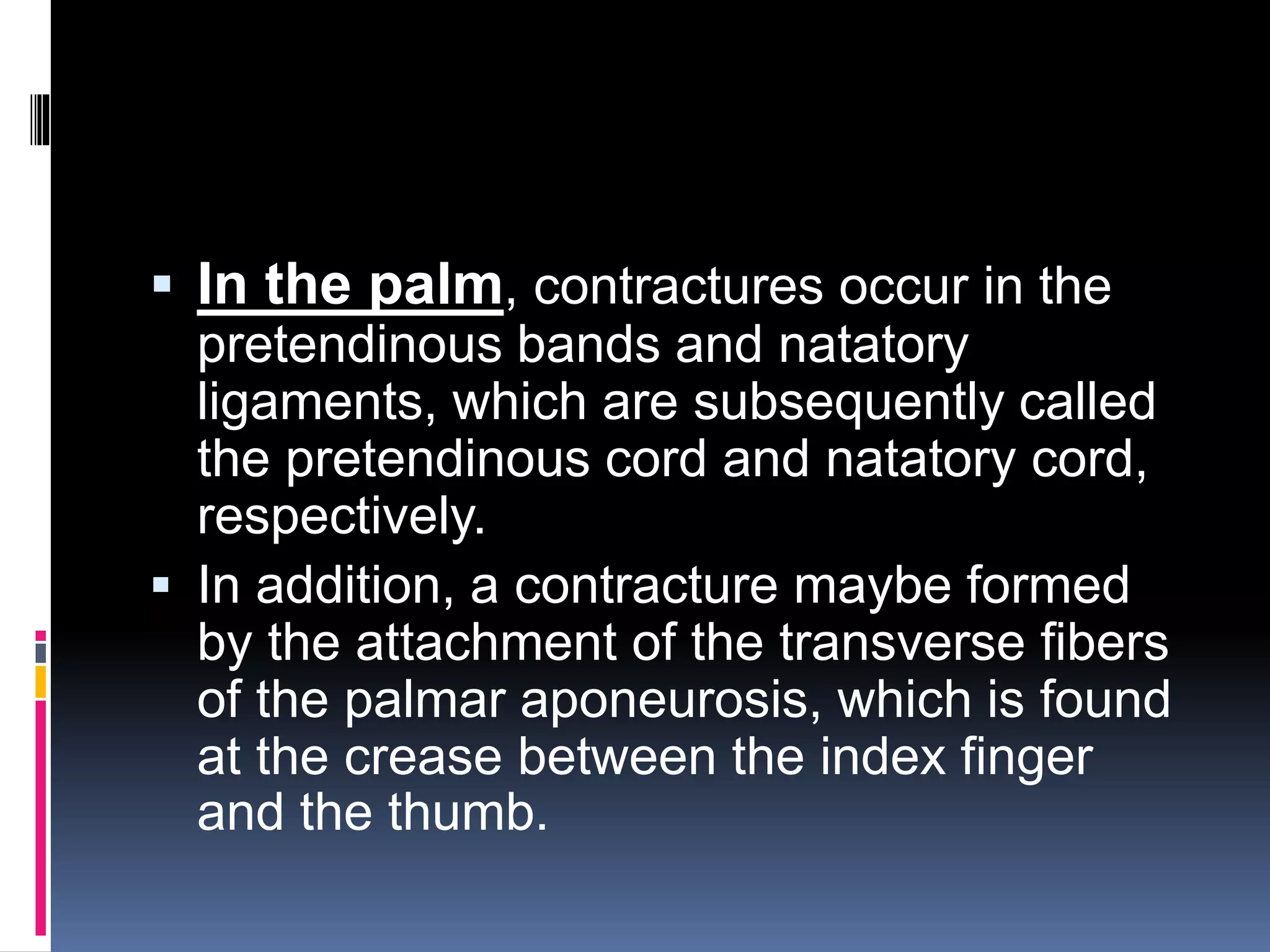 Dupuytrens contracture | PPTX