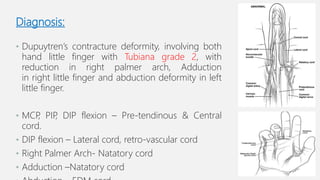 Dupuytren's contracture Plastiquest | PPTX