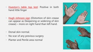 Dupuytren's contracture Plastiquest | PPT