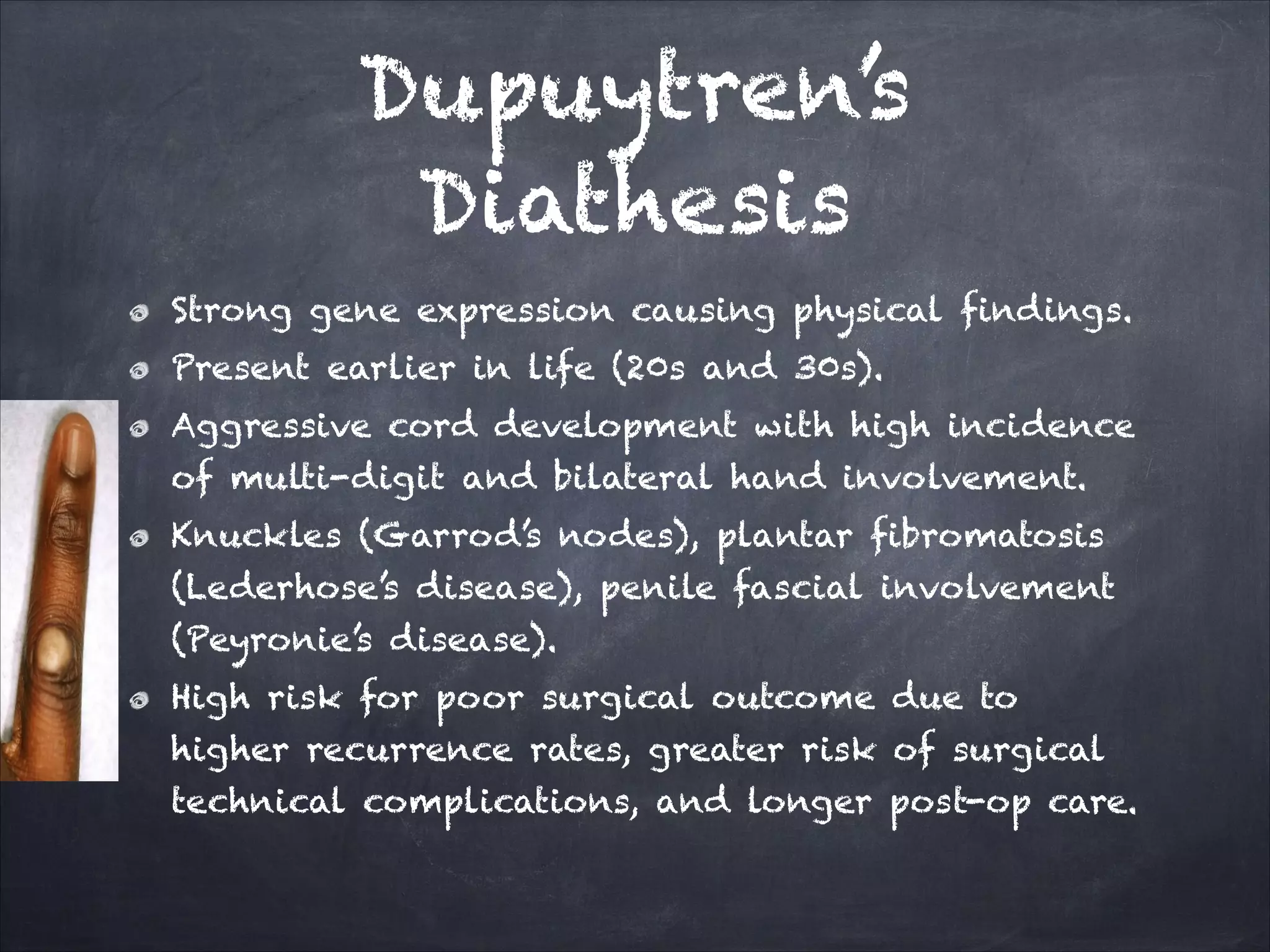 Dupuytrens contracture presentation | PDF