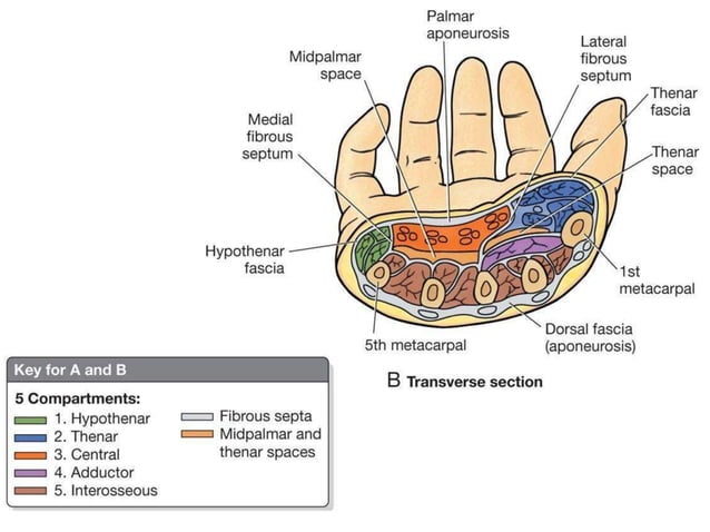 Dupuytren's disease | PPTX