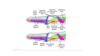 Dupuytrens disease | PPTX