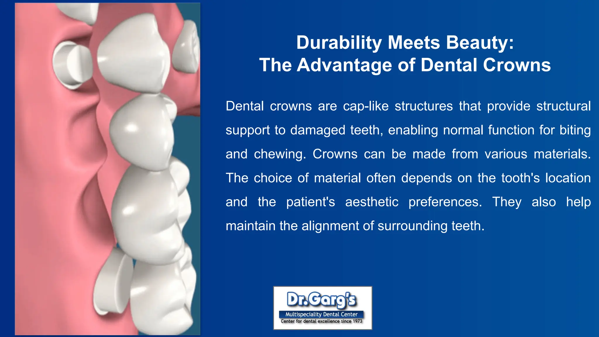 Durability Meets Beauty The Advantage of Dental Crowns.pptx